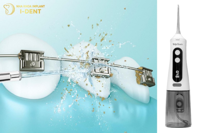 Máy Tăm Nước WaterBeam Có Tốt Không? Ai Nên Dùng?