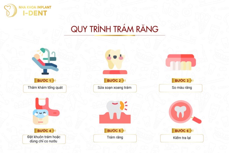 Trám Răng Thưa Bao Nhiêu Tiền?